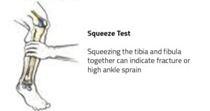 Guide for Speed Up High Ankle Sprain Recovery Time - Your Health Guidelines
