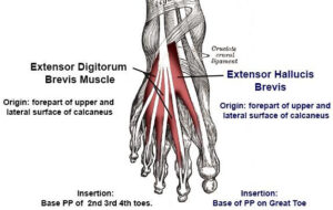 Extensor Tendonitis Foot Braces & Treatment Plan - Your Health Guidelines